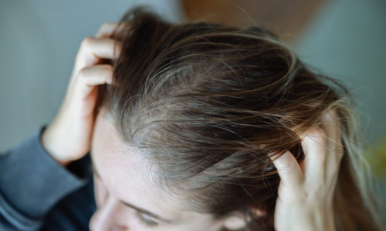 Keeping Your Scalp Clean and Healthy | UK Home Improvement